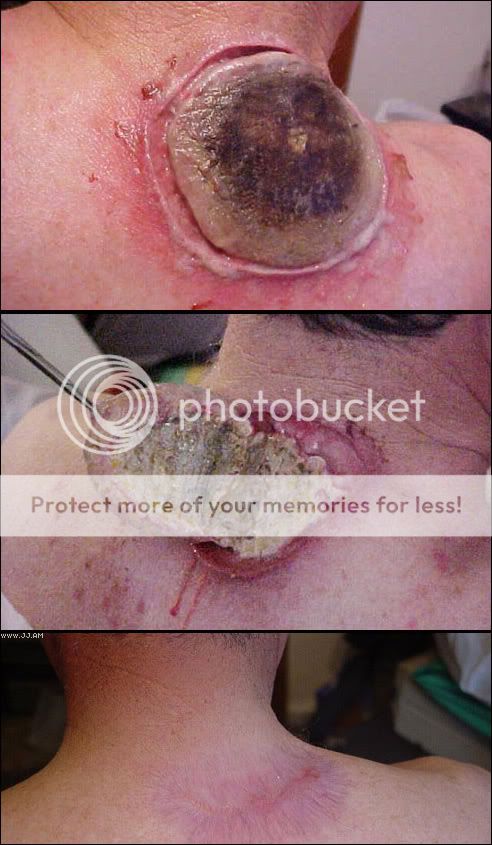 WTF is this? Biggest zit ever?!?! > General Discussion > AR15.COM